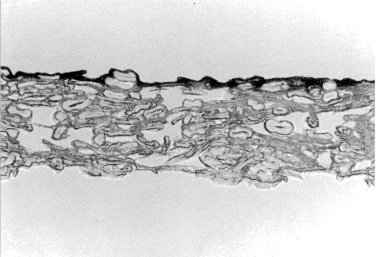 The Three P’s: Porosity, Permeability and Permeance | The Fiber Wire